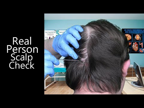 ASMR Real Person Scalp Check & Treatment (NO TALKING) (Gloves, Rat Tail ...