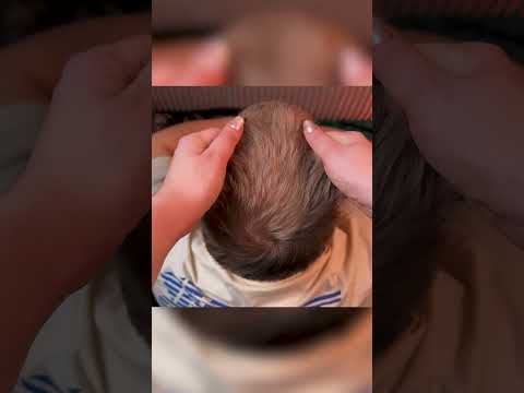 Sleep Instantly with This Gentle Scalp Scratch ASMR