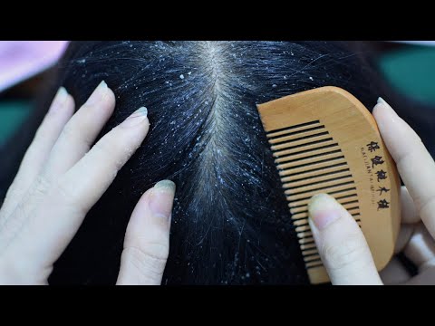 ASMR Relaxing Scalp Check With Comb / Dandruff Scratching / Dandruff ...