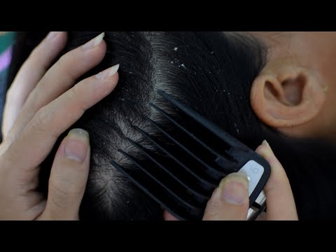 ASMR SHOCKING Dandruff REMOVAL | Hair and Scalp Scratching, Brushing ...