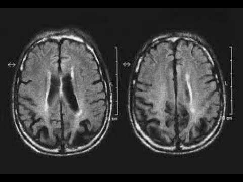 Motion Agnosia Simulation - The ASMR Index