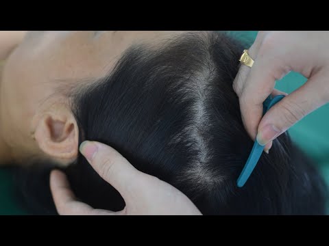 ASMR Relaxing Nape Scratch, Scratching Sounds, Tingly For Reduce Stress