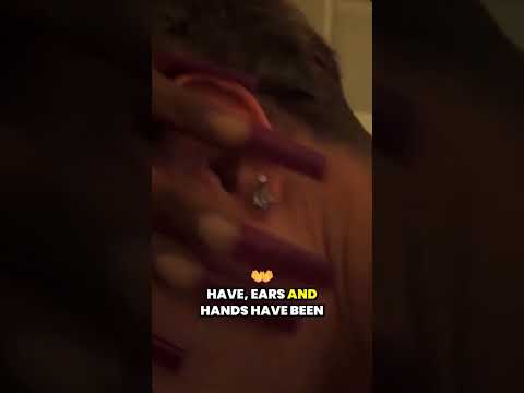 100$ for an EAR scratch? - The ASMR Index