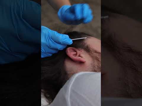 ASMR Real Person Scalp Check & Hair Touching (Soft Spoken Medical Exam) Unintentional ASMR Roleplay