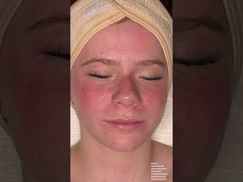 ASMR Facial on Harper Zilmer - The ASMR Index