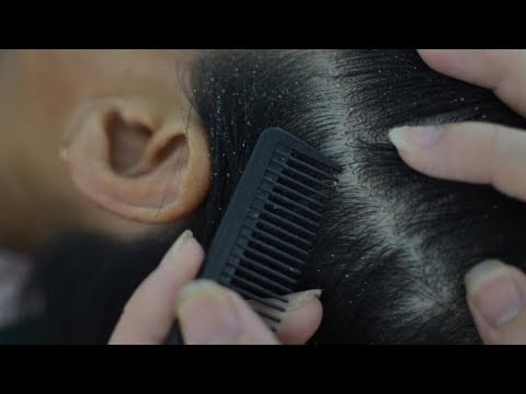 ASMR Scalp Scratching, Scalp Massage Aggressive With Comb For ...