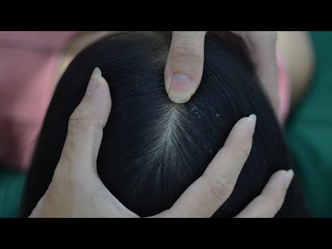 ASMR Scalp Scratching Sounds, Hair Scratching, Hair Massage Relaxing ...