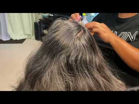 HAIR CRACKING [ASMR] HAIRLINE-HAIR PARTING ~SCALP SCRATCHING~ HEAD ...