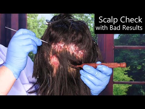 ASMR Dandruff Removal & Scalp Check #asmr #bebravebeyouasmr #asmrscalpcheck