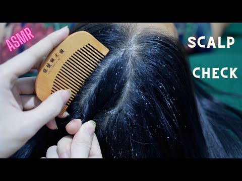 ASMR Tingly Scalp Check, Scalp Massage, Scalp Dandruff Treatment With ...